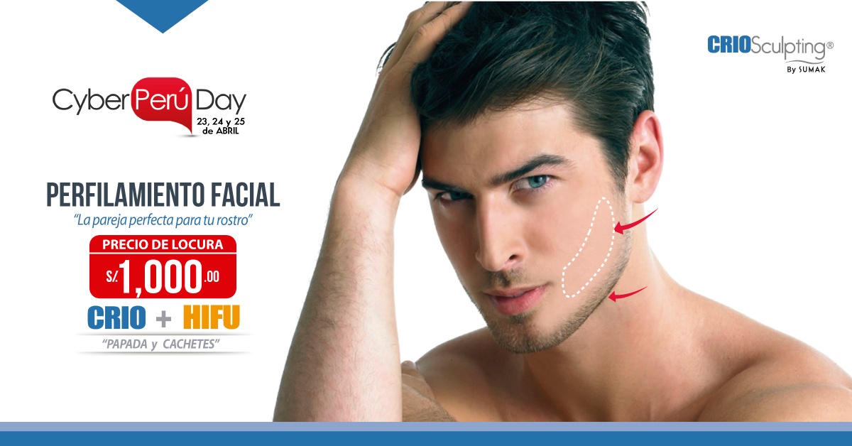 Estética no invasiva - ¡Oportunidad única! Perfilamiento Facial S/.1,000